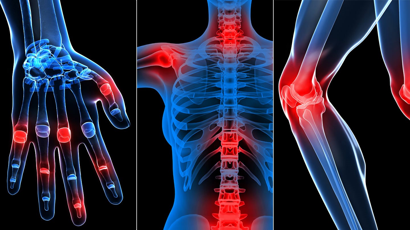 Clínica de reumatologia: conheça a Clínica Croce - Clinica Croce